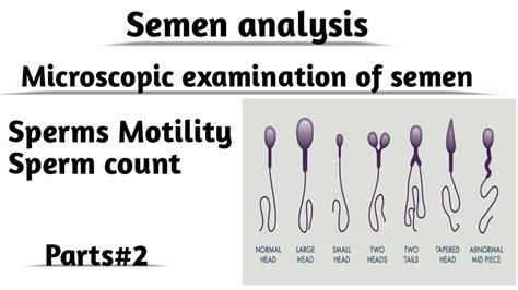 Semen Analysis Microscopic Examination Of Semen Sperms Motility And