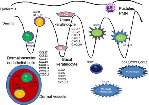 Roles Of Chemokines And Chemokine Receptors In Psoriasis Circulating