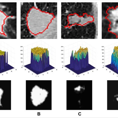 lung nodule classification framework download scientific diagram