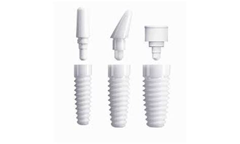 Quels sont les différents types d implants dentaires