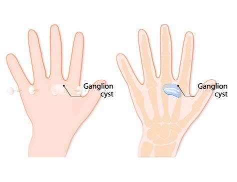 Hand And Upper Extremity Ortho MediSys