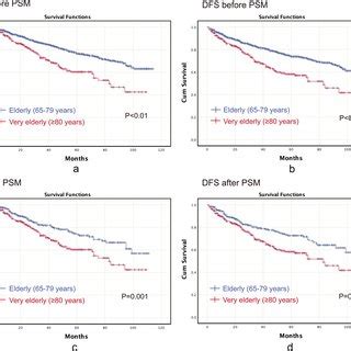 The Kaplanmeier Curve Before And After Psm For Os And Dfs A Os Before