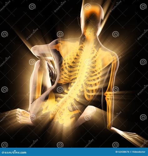 PET CT Scan Image Of Whole Body Comparison Axial Sagittal And Plane