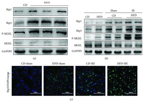 TNFα Mediated Necroptosis Aggravates Ischemia Reperfusion Injury in the