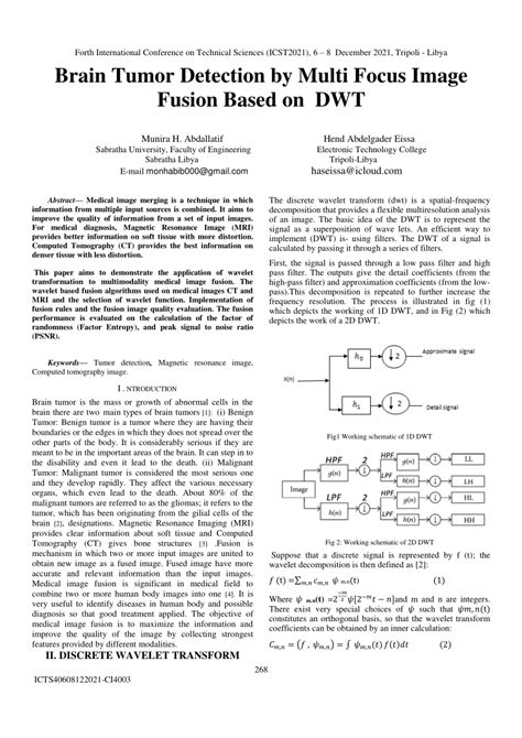 pdf brain tumor detection by multi focus image fusion based on dwt