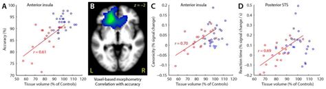 what role does the anterior temporal lobe play in sentence level processing neural correlates