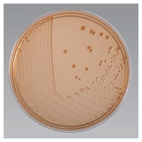 Shigella Sonnei On Macconkey Agar