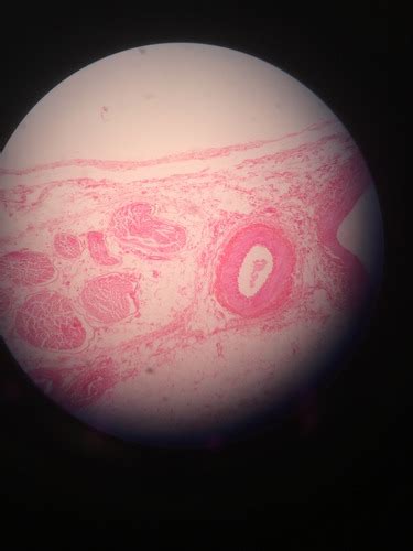 Mc Histo Lab Cardiovascular Lms Flashcards Quizlet
