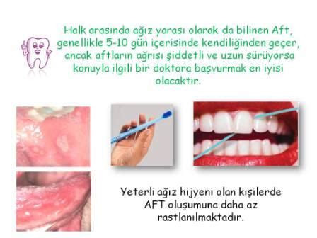 Aft Nedir ve Nasıl Geçer Dr Tuncay Akdoğanlı