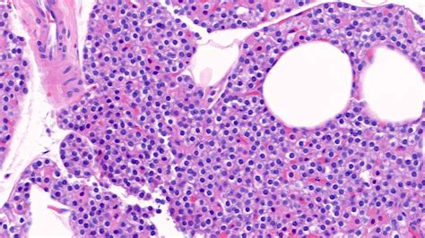 Pathology Outlines Anatomy Histology Parathyroid