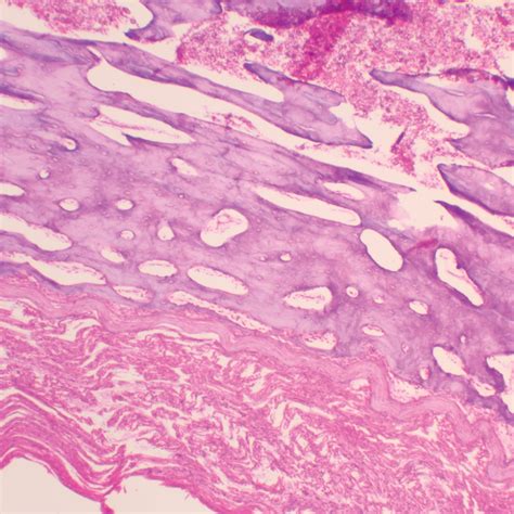Spongy Bone Under Microscope