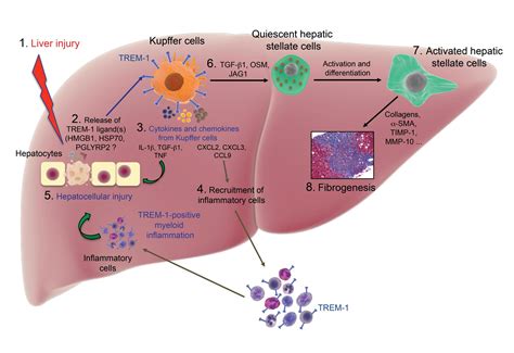 JCI The Innate Immune Receptor TREM 1 Promotes Liver Injury And Fibrosis