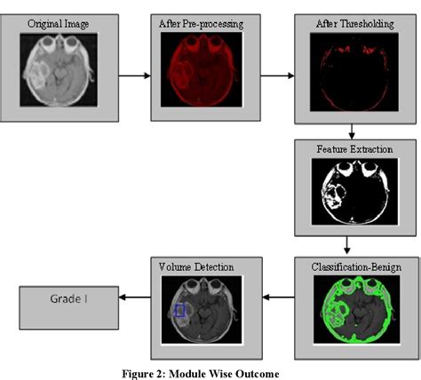 [pdf] a framework for brain tumor classification and grade detection from magnetic resonance