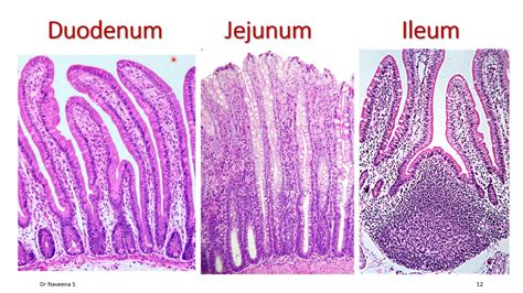 Human Duodenum Histology