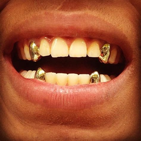 Silver Canine Teeth Gold Teeth Gold Tooth Cap Teeth Jewelry