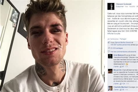 Agression homophobe à Montpellier torrent de réactions sur les