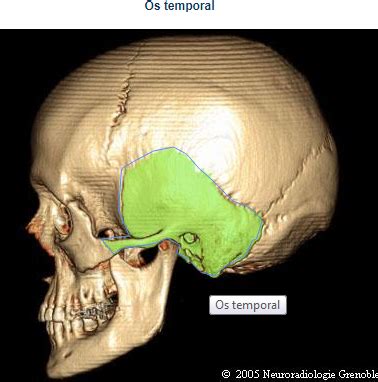 Mp Cbct Radio Anatomy Imaging