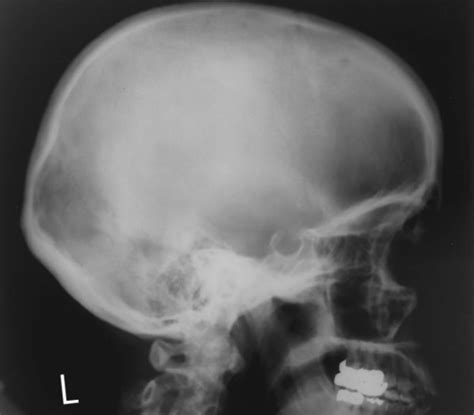 Lab Quiz Skull Facial Bones Flashcards Quizlet