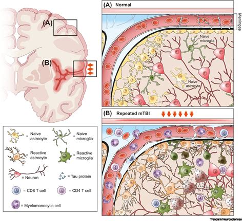 How The Immune System Shapes Neurodegenerative Diseases Trends In