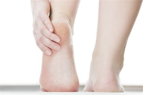 Como curar ampollas en los pies Consejo al Día
