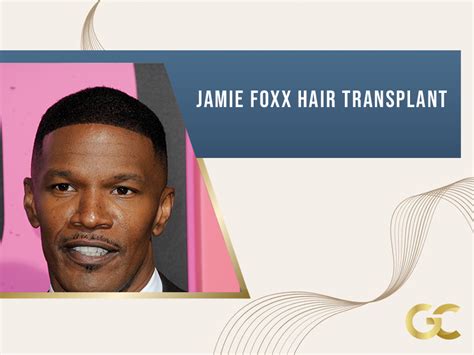 Jamie Foxx Hair Transplant Gold City Best Hair Transplant Turkey