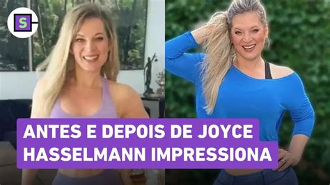 Joice Hasselmann Perde 22 Quilos E Mostra Antes E Depois Do Corpo YouTube
