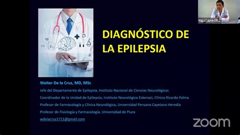 DIAGNÓSTICO DE EPILEPSIA YouTube