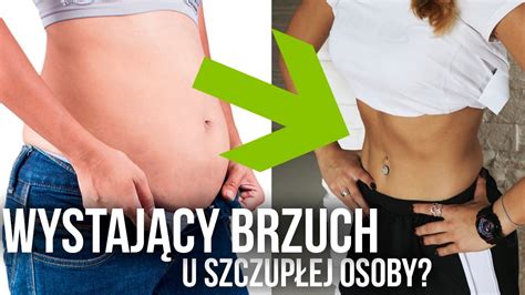 Dlaczego Masz Wystaj Cy Brzuch Przyczyn I Porad Jak Sobie Radzi