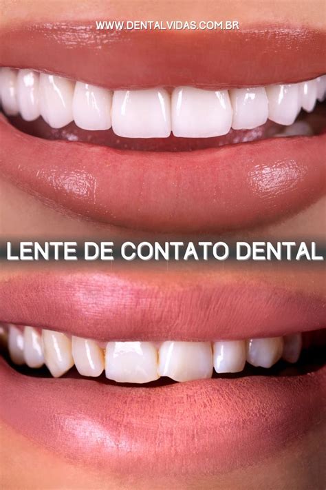 Para quem almeja um sorriso bonito e saudável as visitas regulares ao