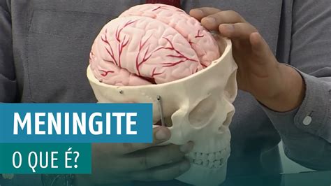 O Que Meningite Conhe A Os Sintomas E As Causas Youtube