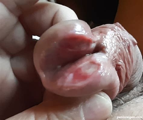 Gespaltene Eichel Kostenlose Penis Bilder Und Schwanzfotos