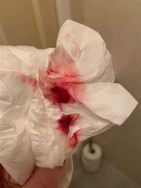 Implantation Bleeding Glow Community