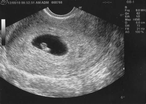 Khoảnh khắc đầu tiên mẹ nhìn rõ mặt con khi siêu âm 4D Báo Dân trí