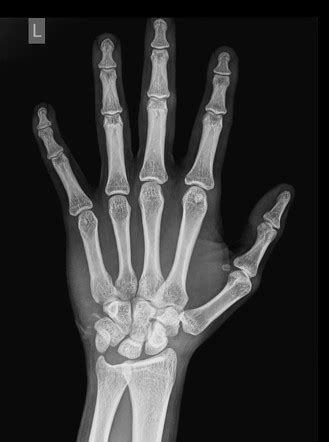 Radiology Quiz 48306 Radiopaedia Org