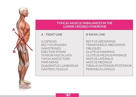 Msk Posture Flashcards Quizlet