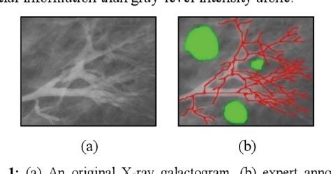 figure 1 from segmentation of anatomical branching structures based on texture features and