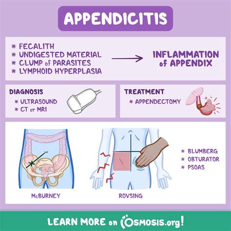 Osmosis From Elsevier On Twitter Are You An Appendix Because I D