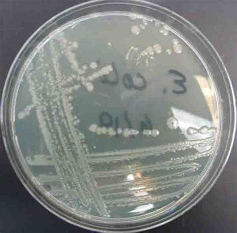 Microbio Lab Exam 1 Flashcards Quizlet