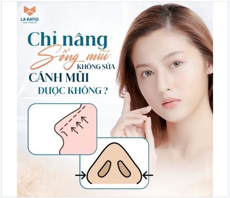 Chỉ nâng SỐNG MŨI không sửa CÁNH MŨI được không