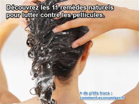 11 Remèdes Naturels Pour se Débarrasser des Pellicules