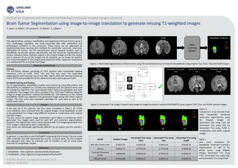 pdf brain tumor segmentation using image to image translation to generate missing t1 weighted
