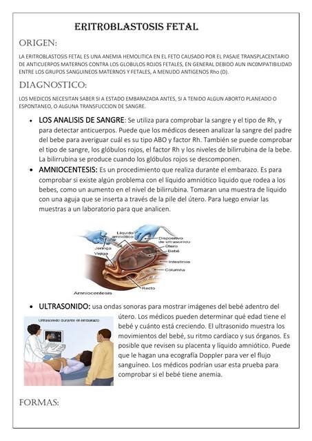 Eritroblastosis Fetal Mariana Soliz Udocz