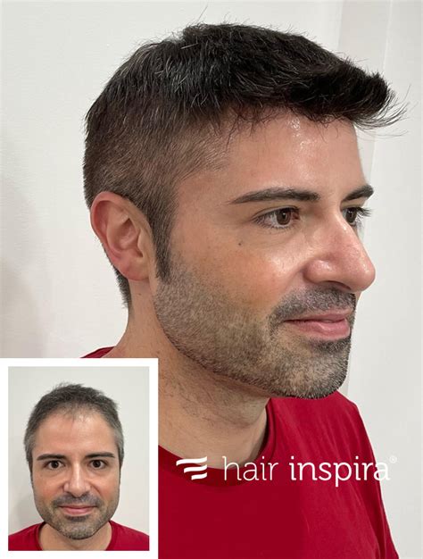 Prótesis capilar hombre la experiencia de José Ramón Hair Inspira