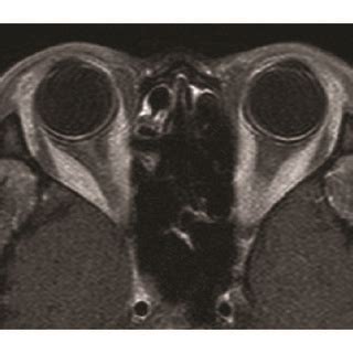 External Facial Photograph And Enhanced Magnetic Resonance MR Images