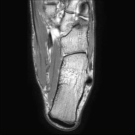 Normal Foot Ankle Mri Axial View Diagram Quizlet