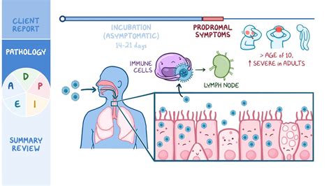 Chickenpox Varicella Nursing Process ADPIE Osmosis Video Library