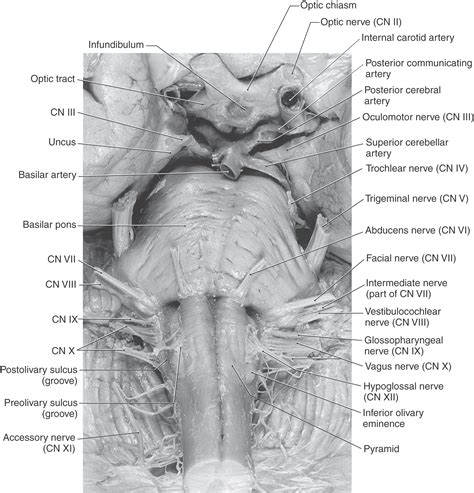 A Synopsis Of Cranial Nerves Of The Brainstem Clinical Gate