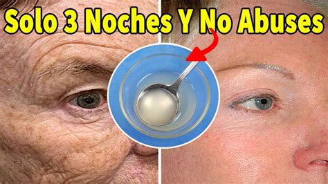 5 Remedios Caseros Para Reducir Arrugas En La Cara