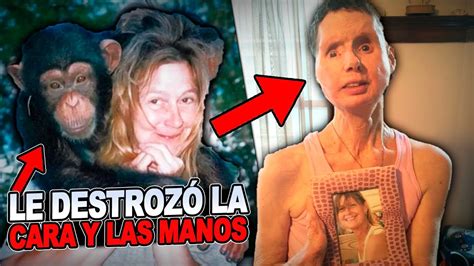 ESTE CHIMPANCÉ LE DESTROZÓ La CARA A Su AMIGA El Caso De Charla Nash