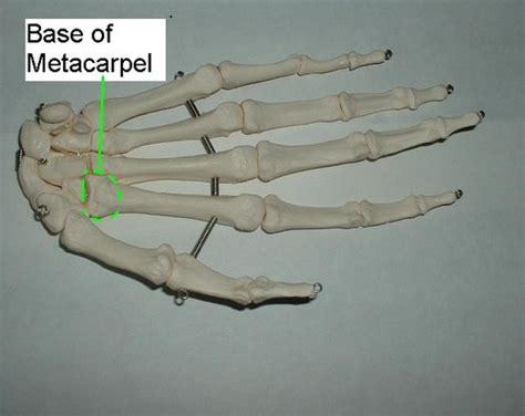 The Bones Of The Hand And Wrist Flashcards Quizlet